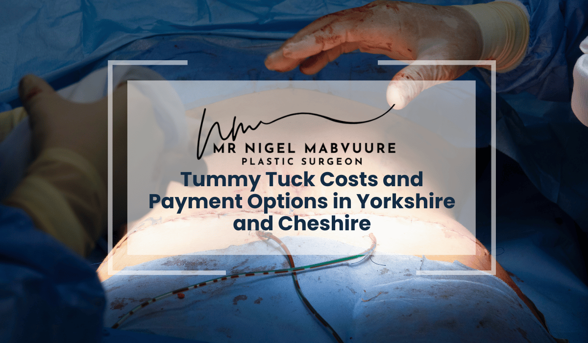 Understanding Tummy Tuck Costs and Payment Options in Yorkshire and ...